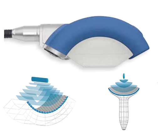 Piezo Wave 2 | Hill DT Solutions